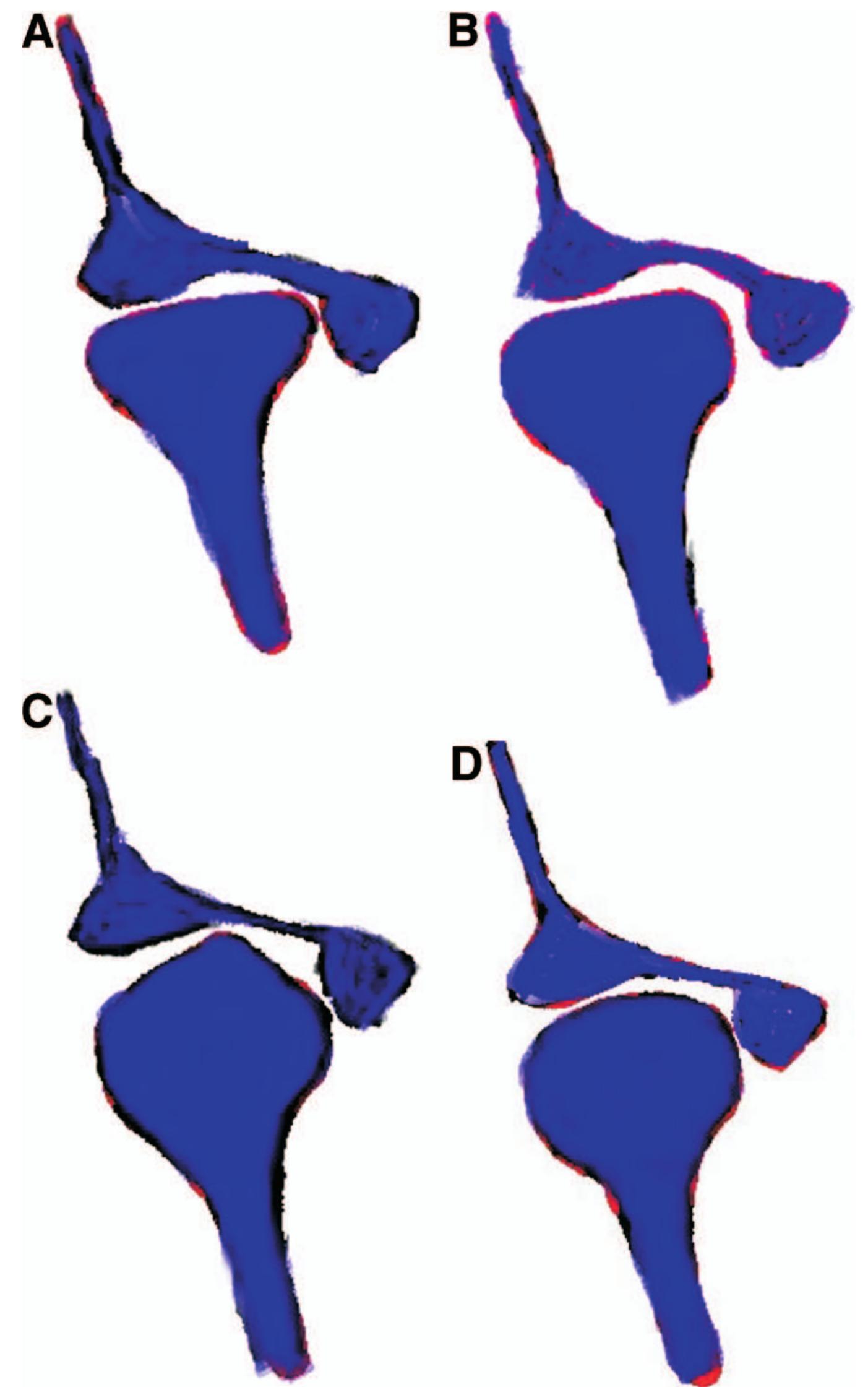 Variations in the morphologic architecture of the mandibular