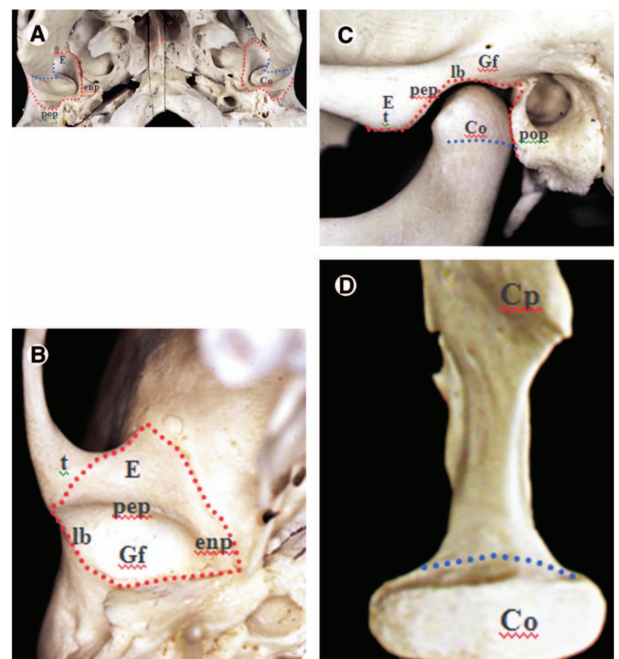 Bone anatomy and synovial insertion of the two components of