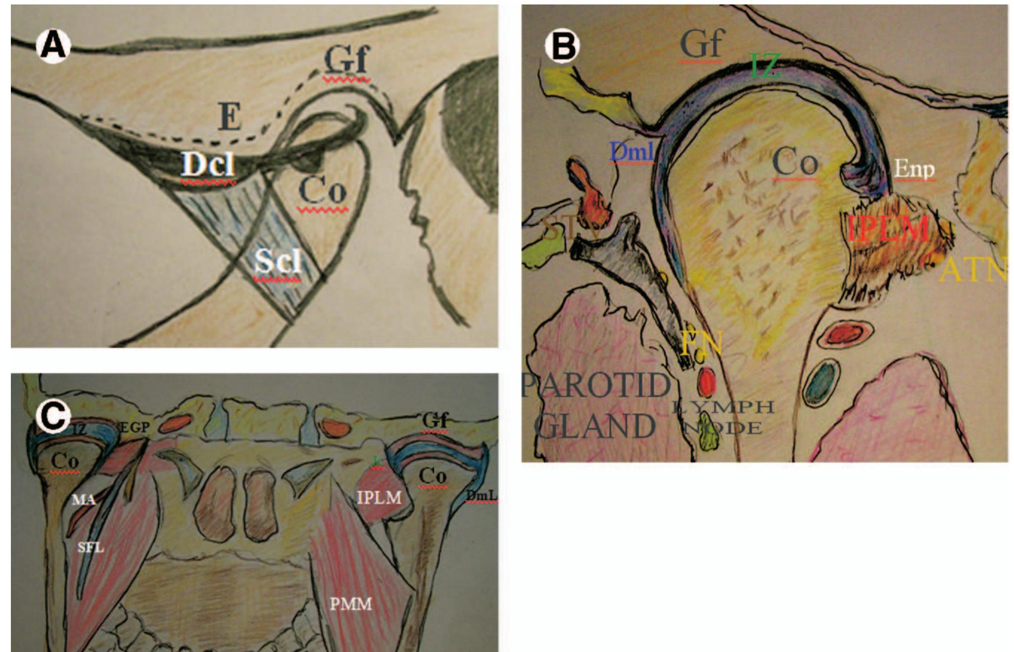 Dm: collateral disko-mandibular ligaments of the tmj; scl: