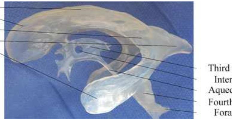 The frontal (anterior) horn extends anteriorly from the