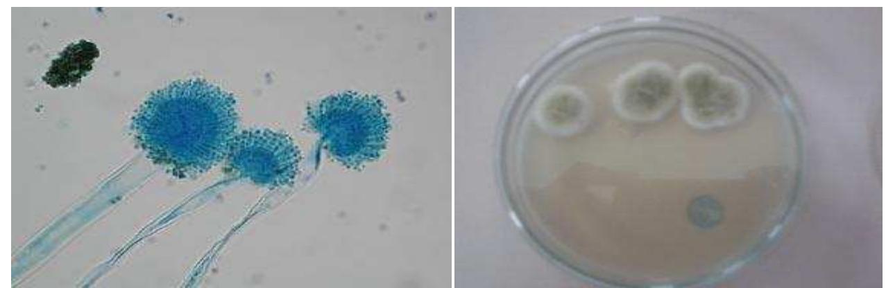 Lpcb staining shows conidiophores of aspergillus flavus 3.2.