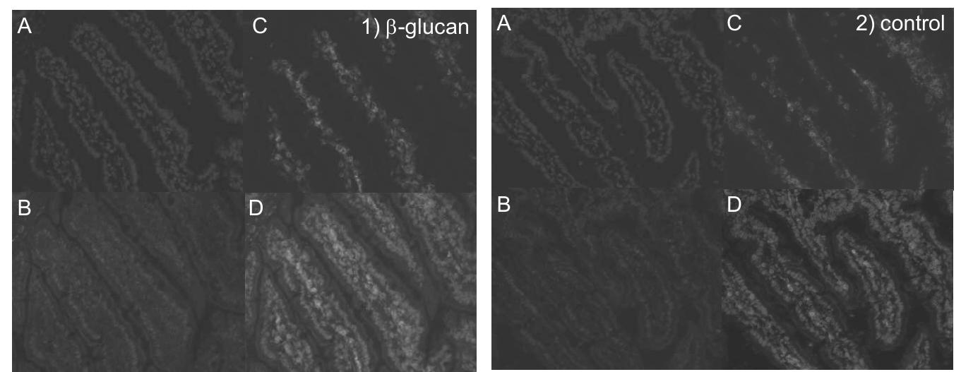 Distal part of the small intestine, and the colon,