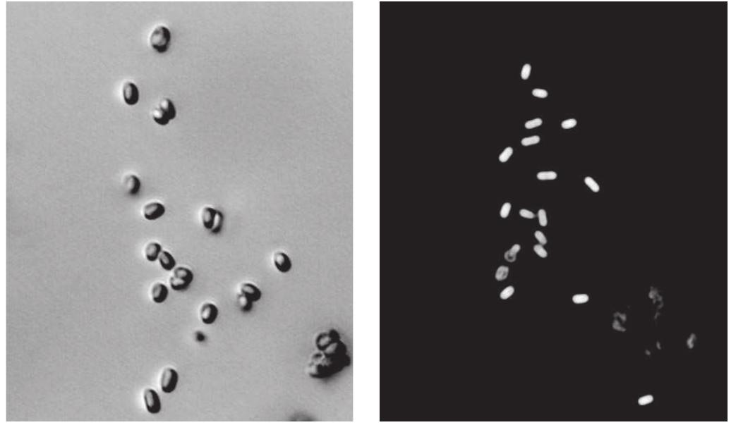 B. subtilis spores under the microscope. (left) regular