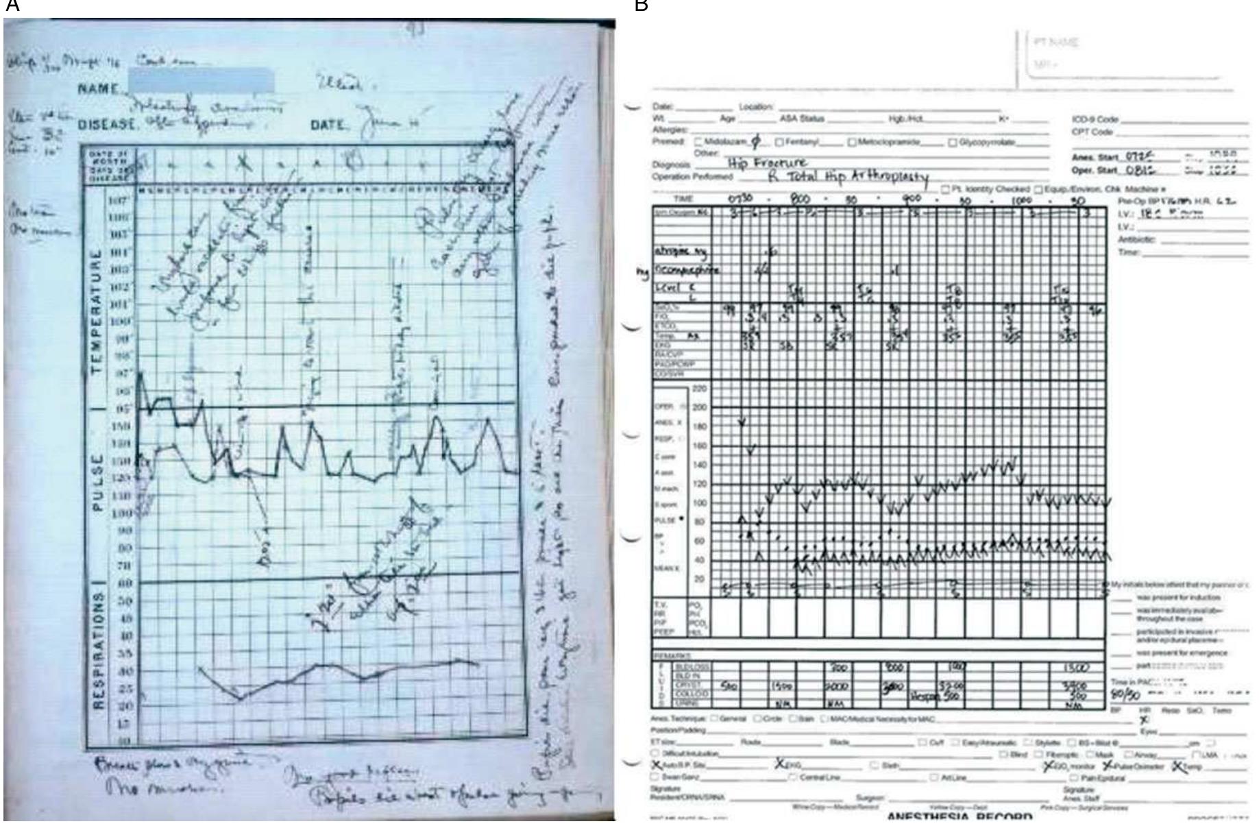 Ether chart and a modern-day anesthetic record. (a) the