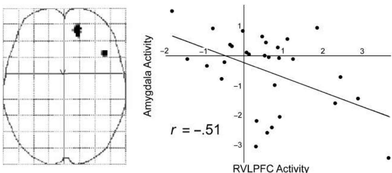 (PDF) Putting Feelings Into Words: Affect Labeling Disrupts Amygdala ...