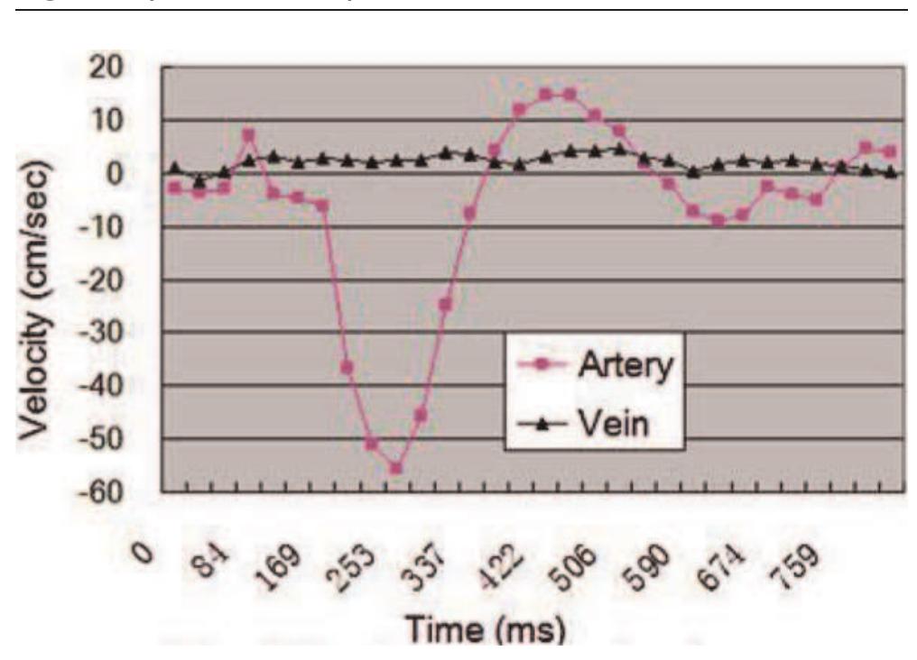Typical blood velocity curve in one cardiac cycle.