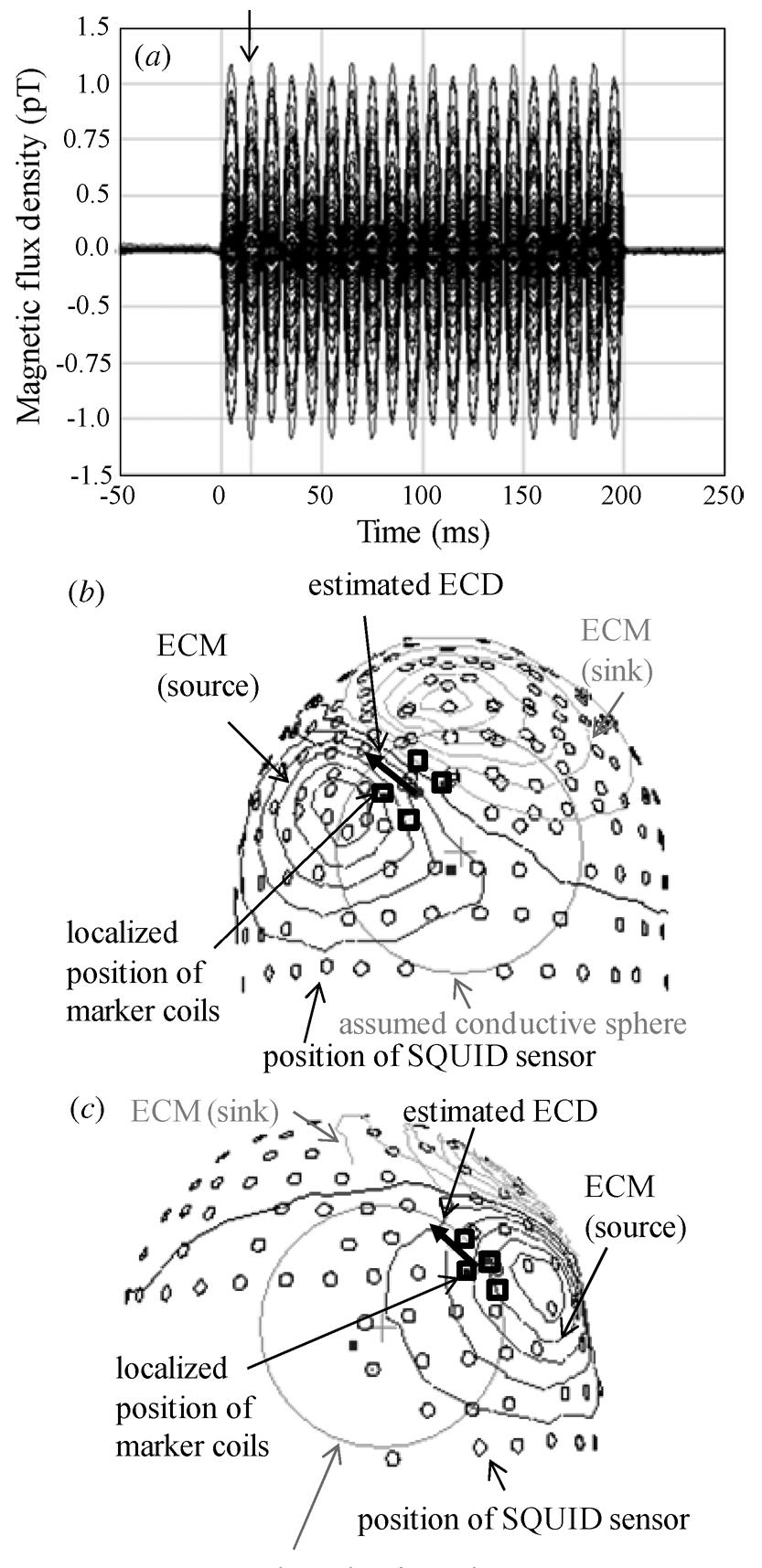 Figure 4 - Evaluation of an Isosceles-Triangle-Coil Phantom
