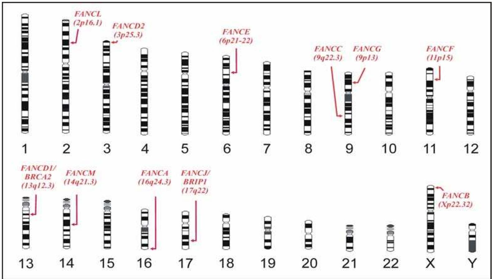 Human karyotype map with locations of the 11 fanconi anemia