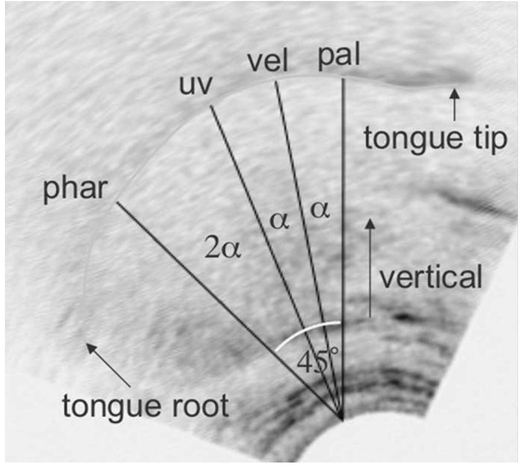 Ultrasound image showing tongue measurement locations for