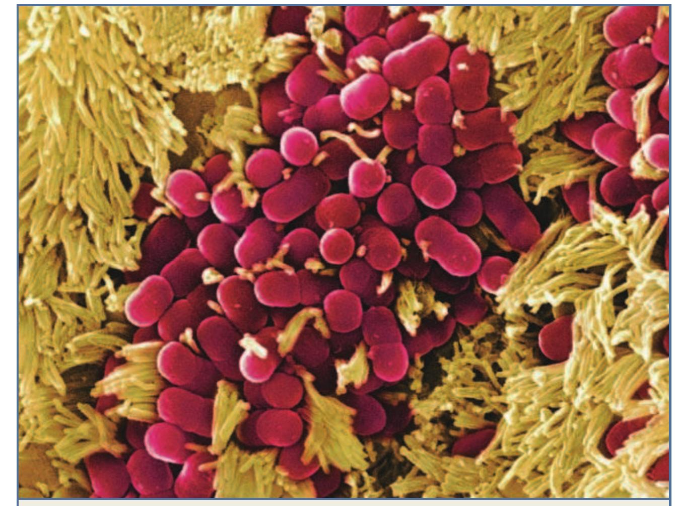 1 e. coli adhering to the surface of the small intestine.