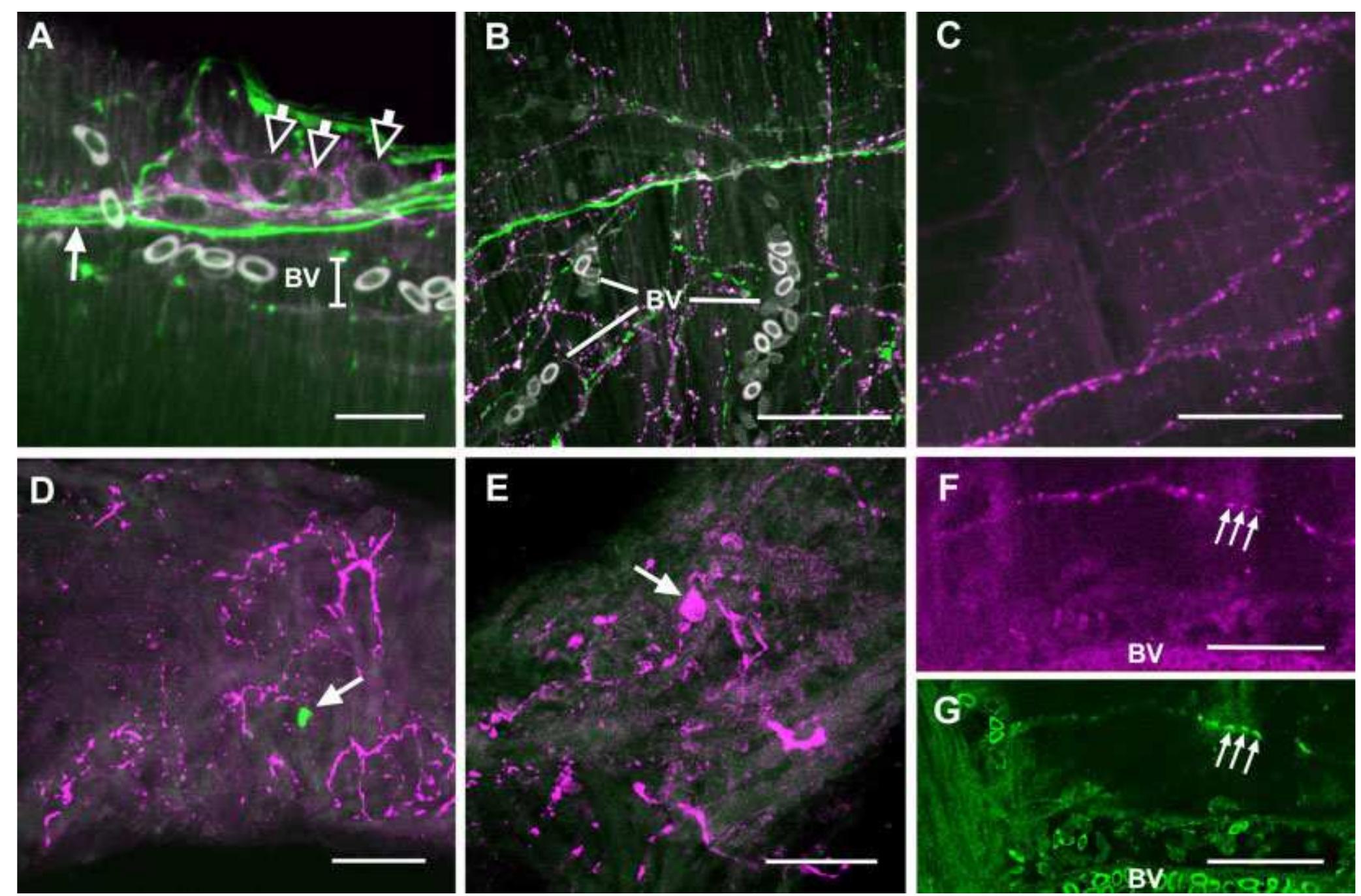 Double labelling of the swim bladder system. a: green. th-ir