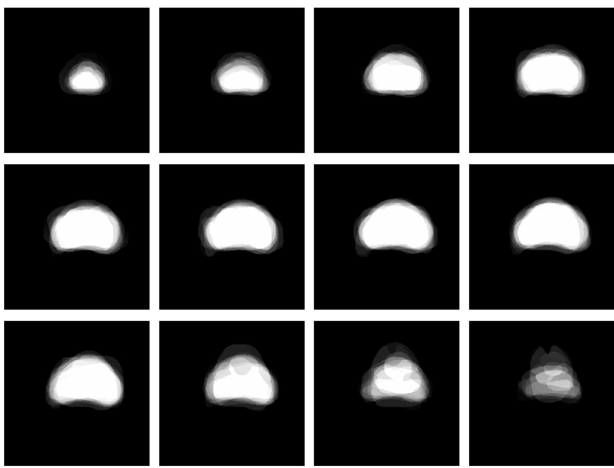 Overlap images of consecutive axial slices of the eight 3-d