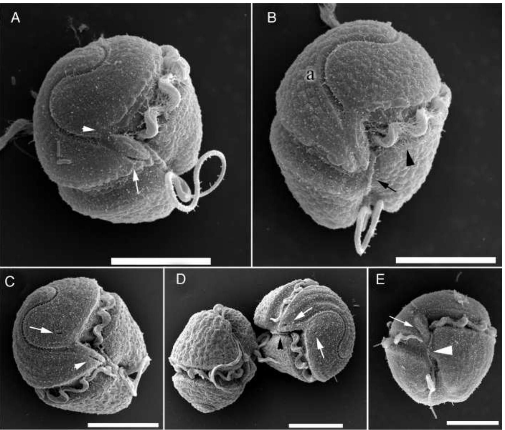 Fic. 3. scanning electron micrographs of takayama tasmanica