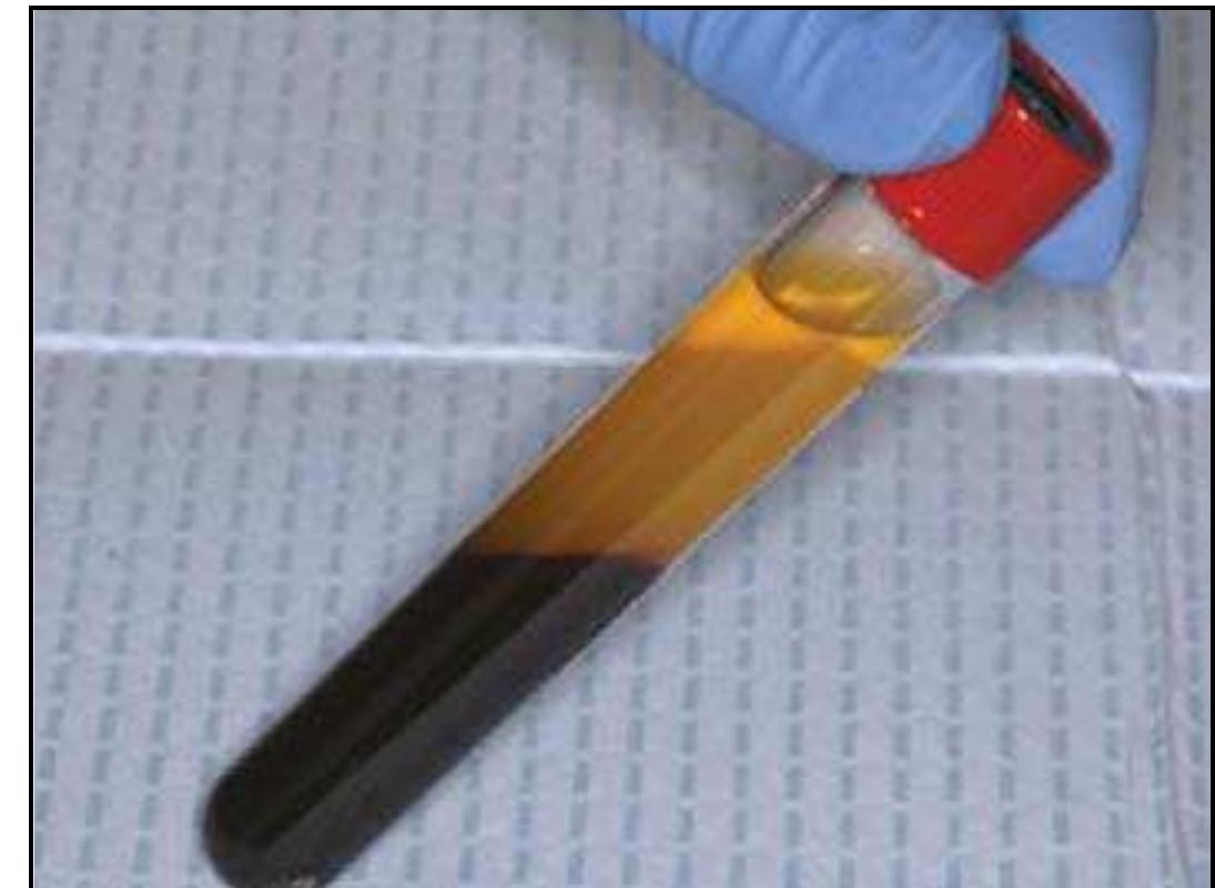 (PDF) Introducing Choukroun’s Platelet Rich Fibrin (PRF) to the ...