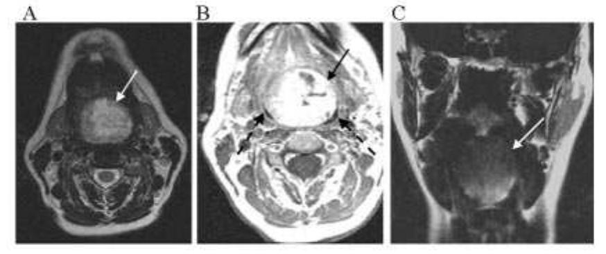 Horizontal (a ad b) and coronal (c) mri images of the head