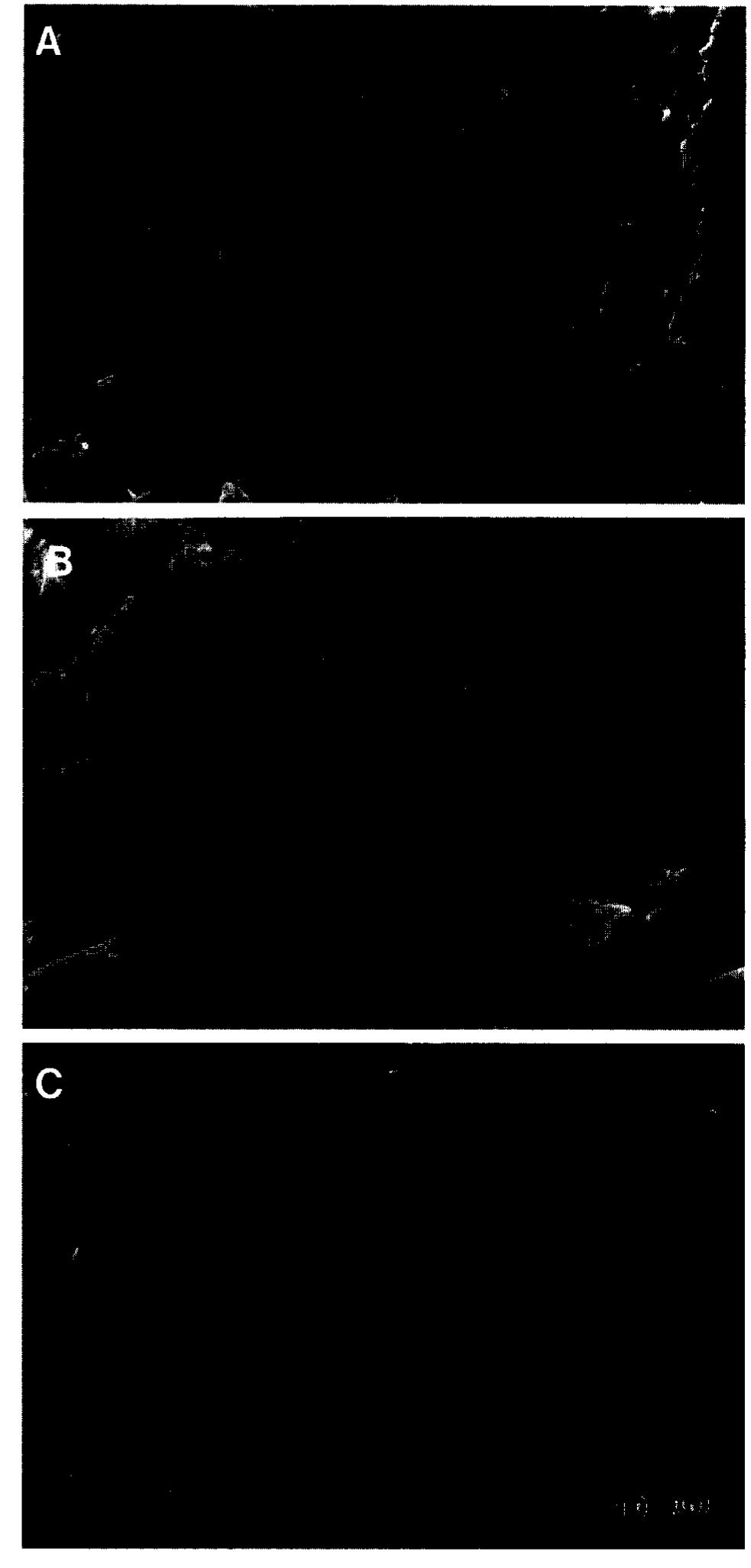 Sem micrographs of biofilm bacteria on surfaces of (a)