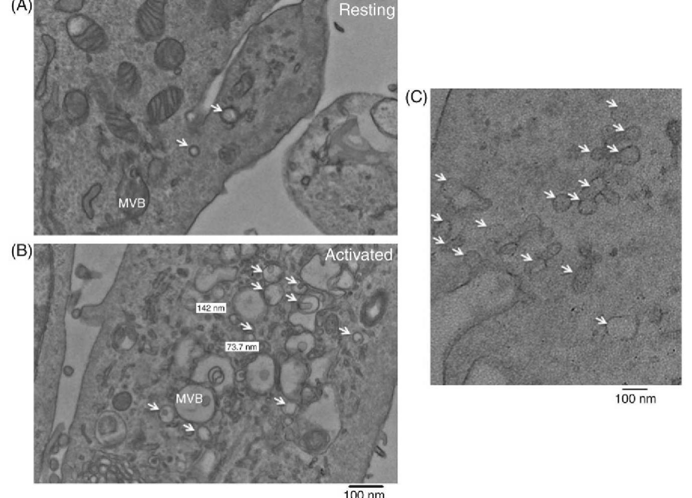 4 electron microscopic image of exosomes and multivesicular