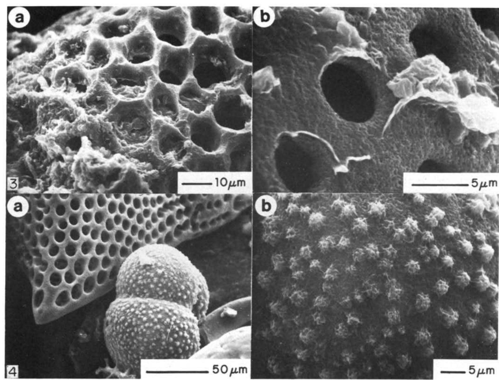 Scanning electron microscope photographs of: (a) filling of