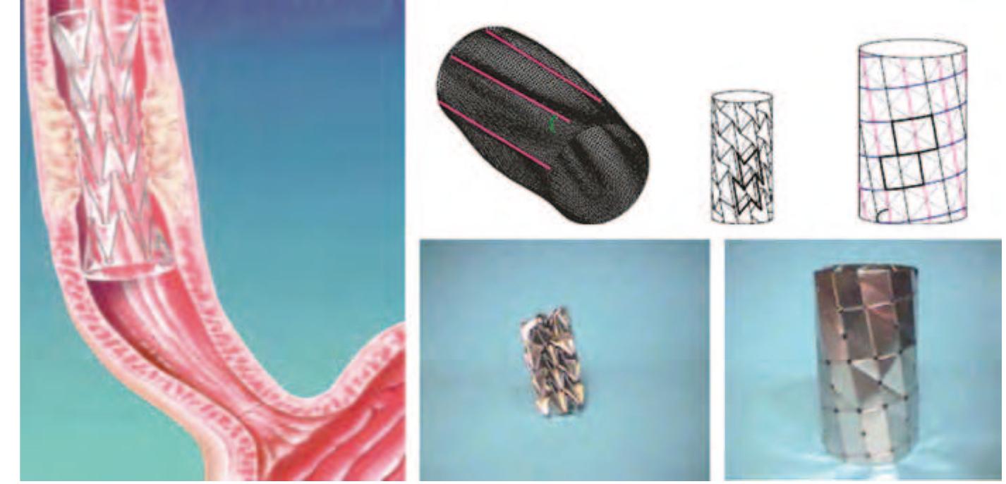 Called “innovative origami expandable stents” by kaori