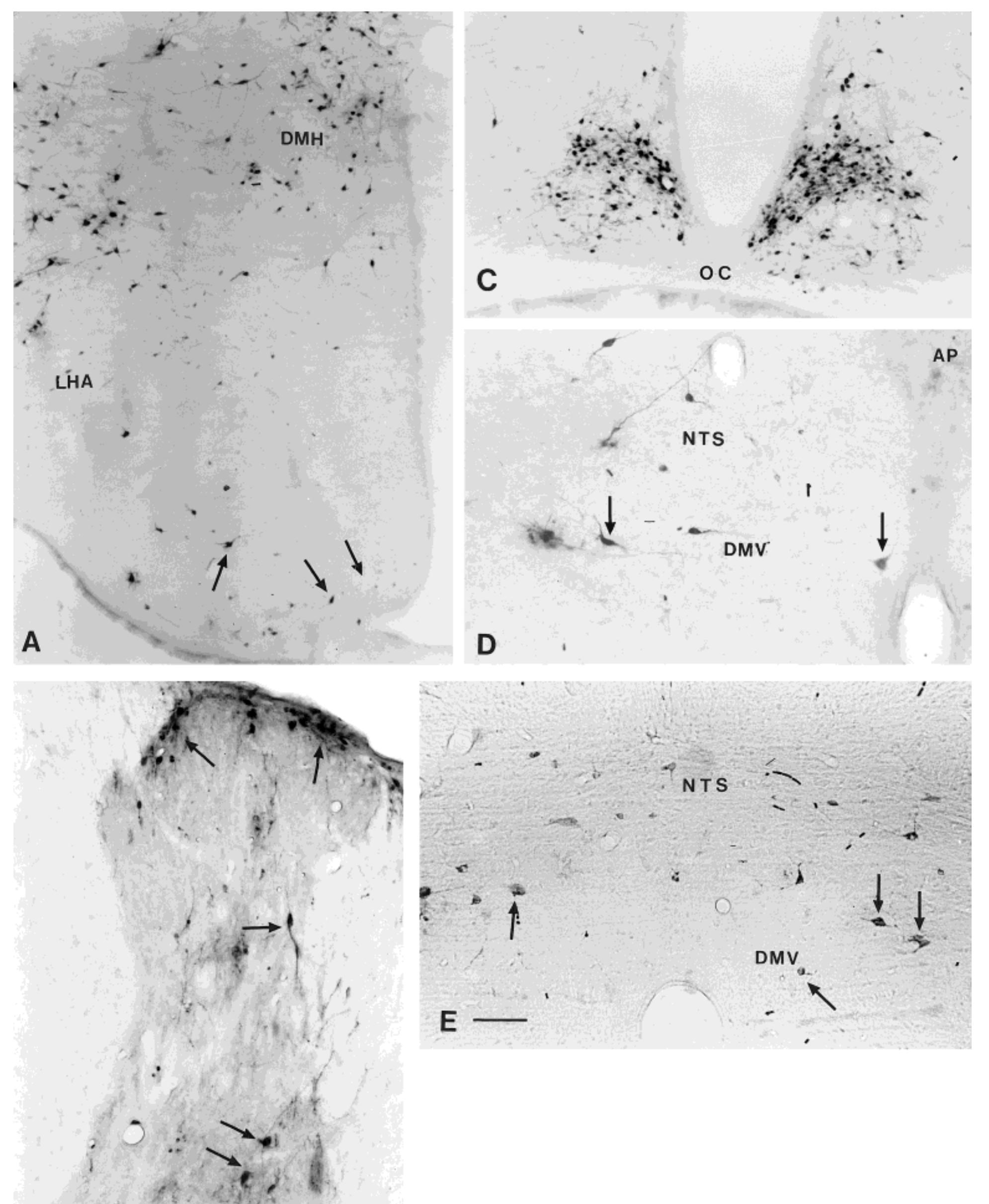 Transverse sections of the rat brain stained for pseudora-