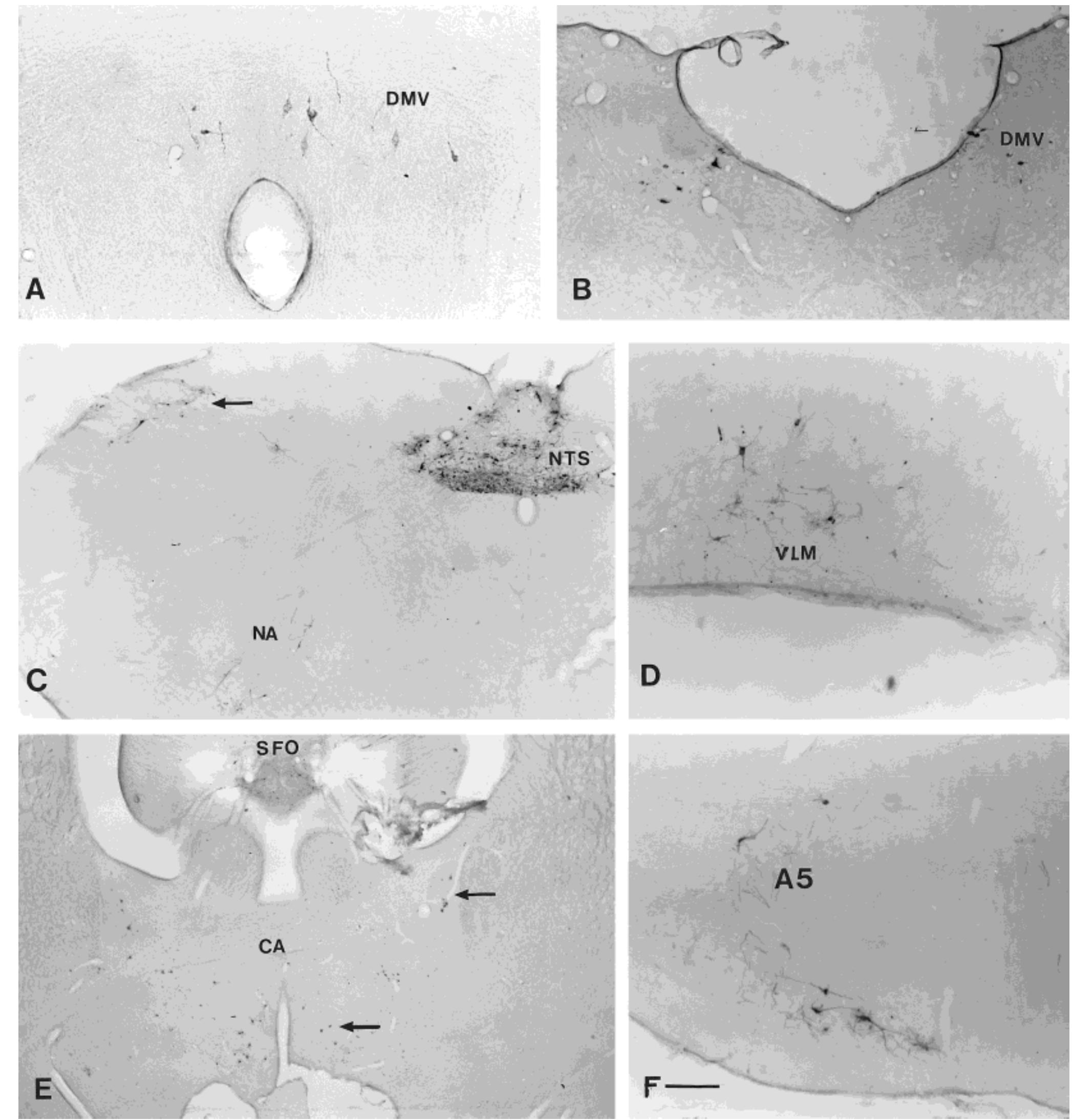 Transverse sections of the rat brain stained for pseudora-