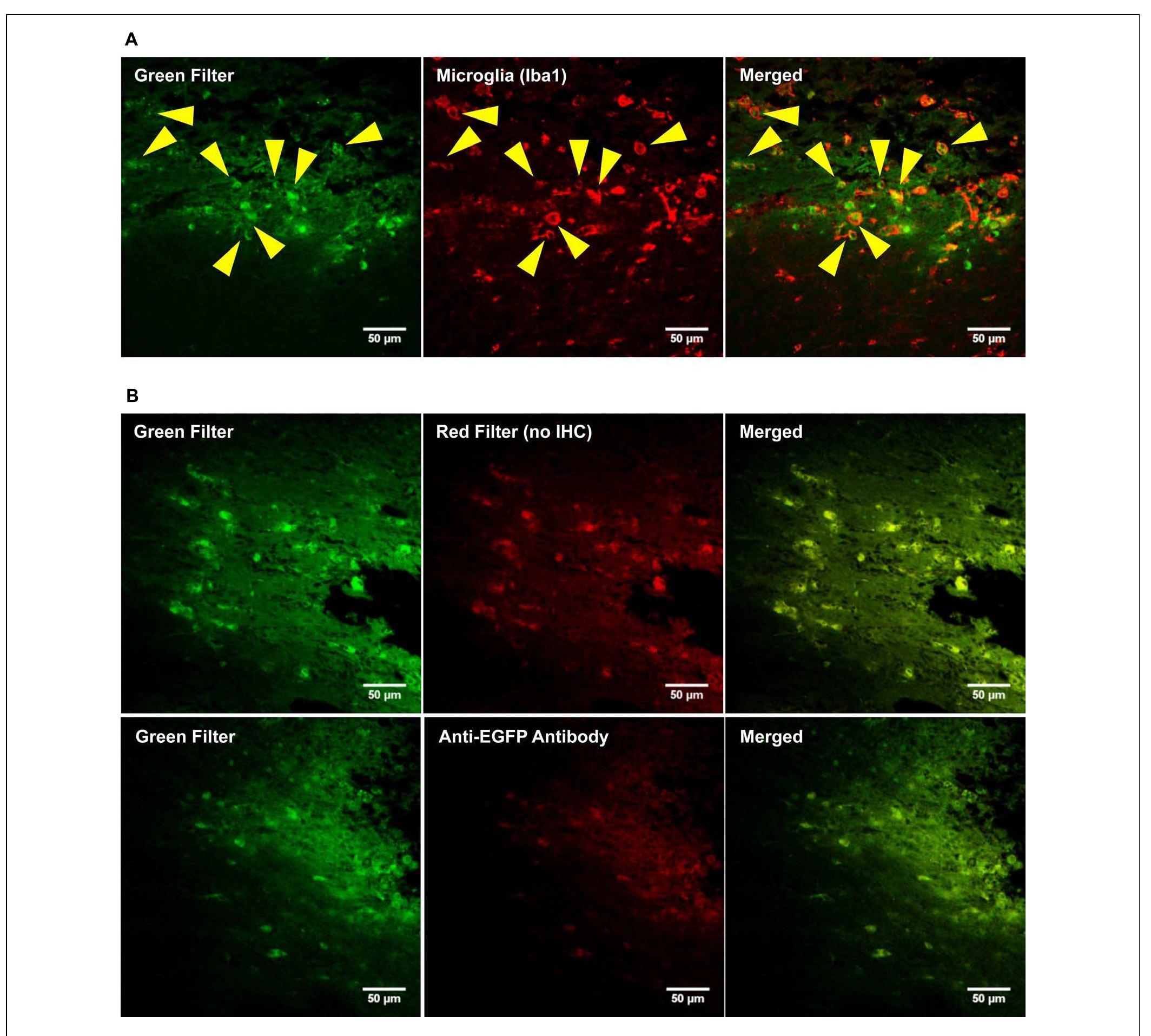 Imaging of brain sections (dorsal striatum) revealed that