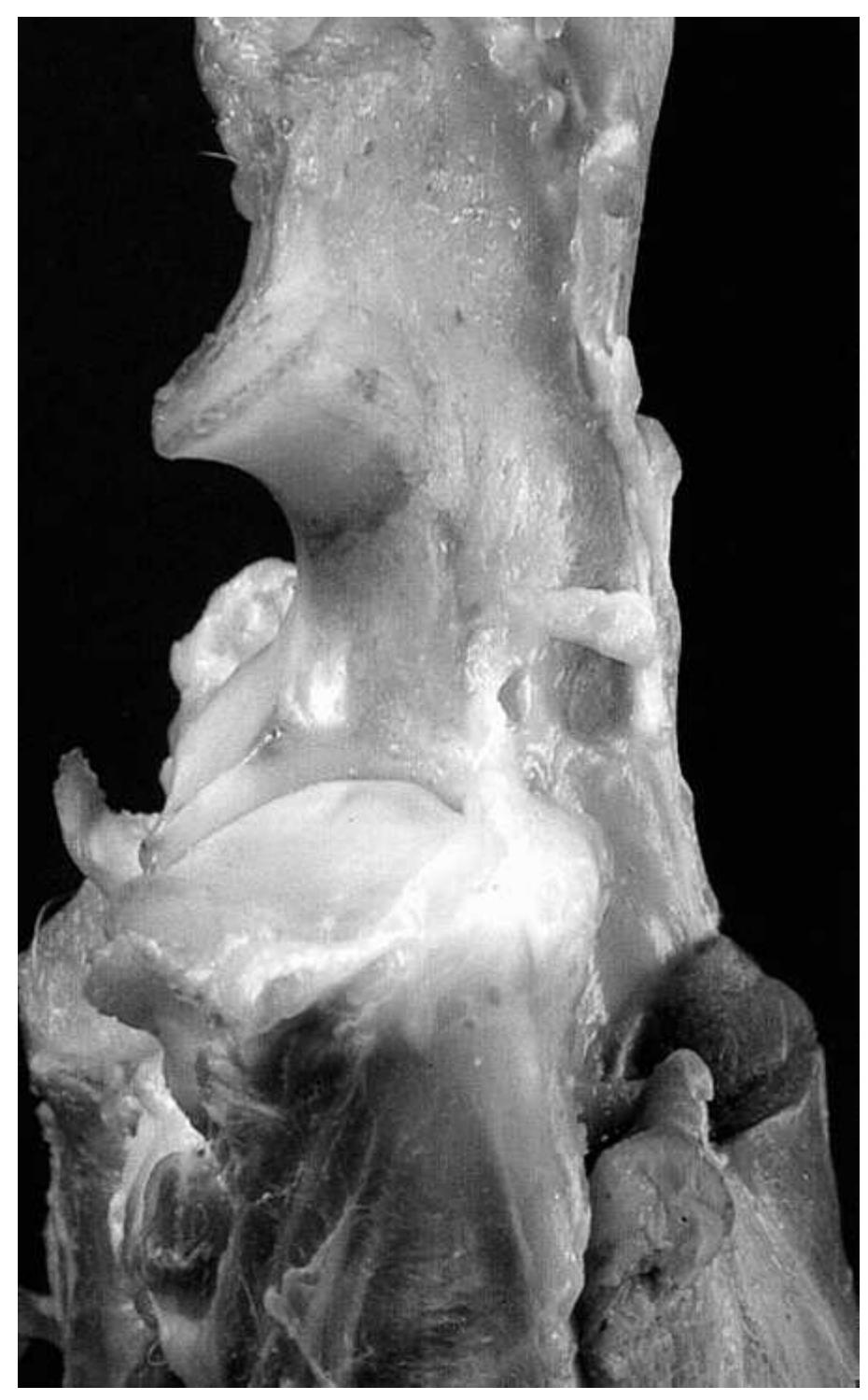 Photograph of the proximal radial and ulnar articular