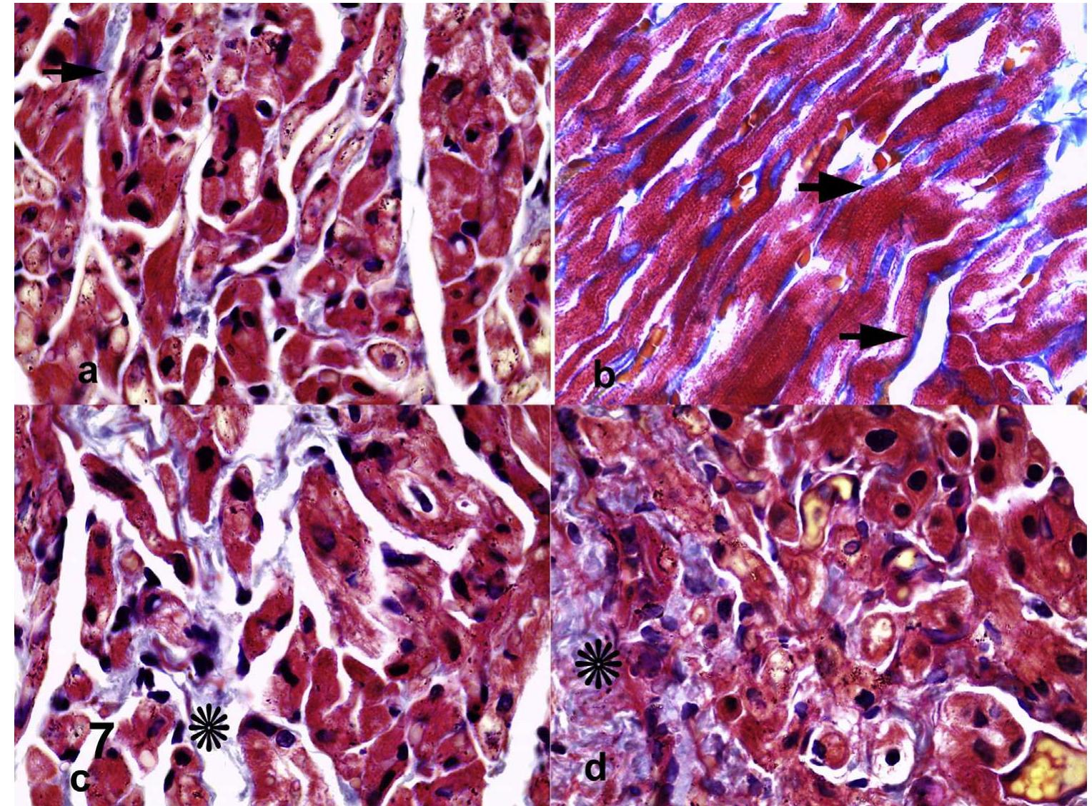Photomicrographs of left ventricle muscle sections of rates