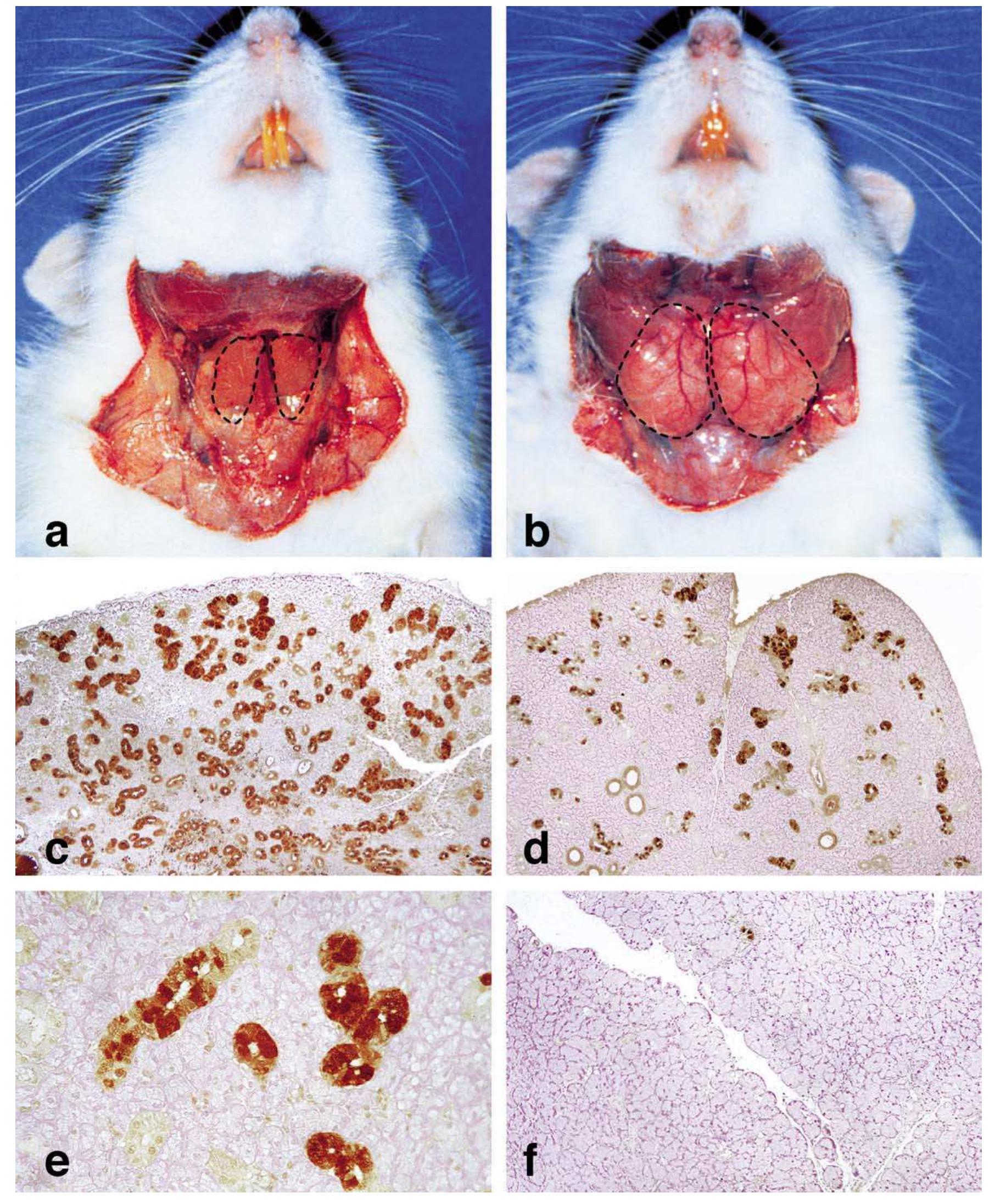 Macroscopic appearance of the submandibular glands in (a) a