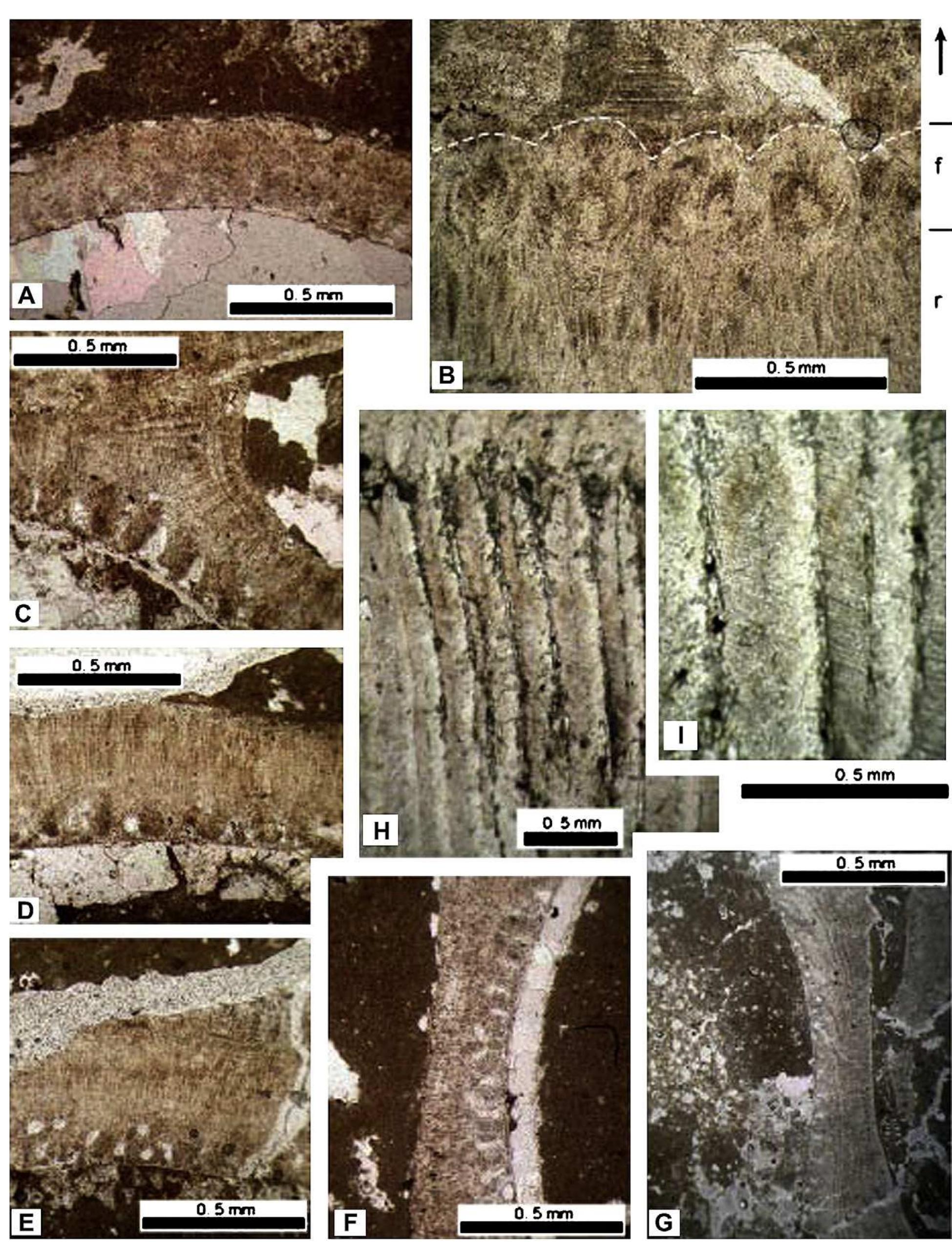 Types of microstructures of the inner margin of the outer