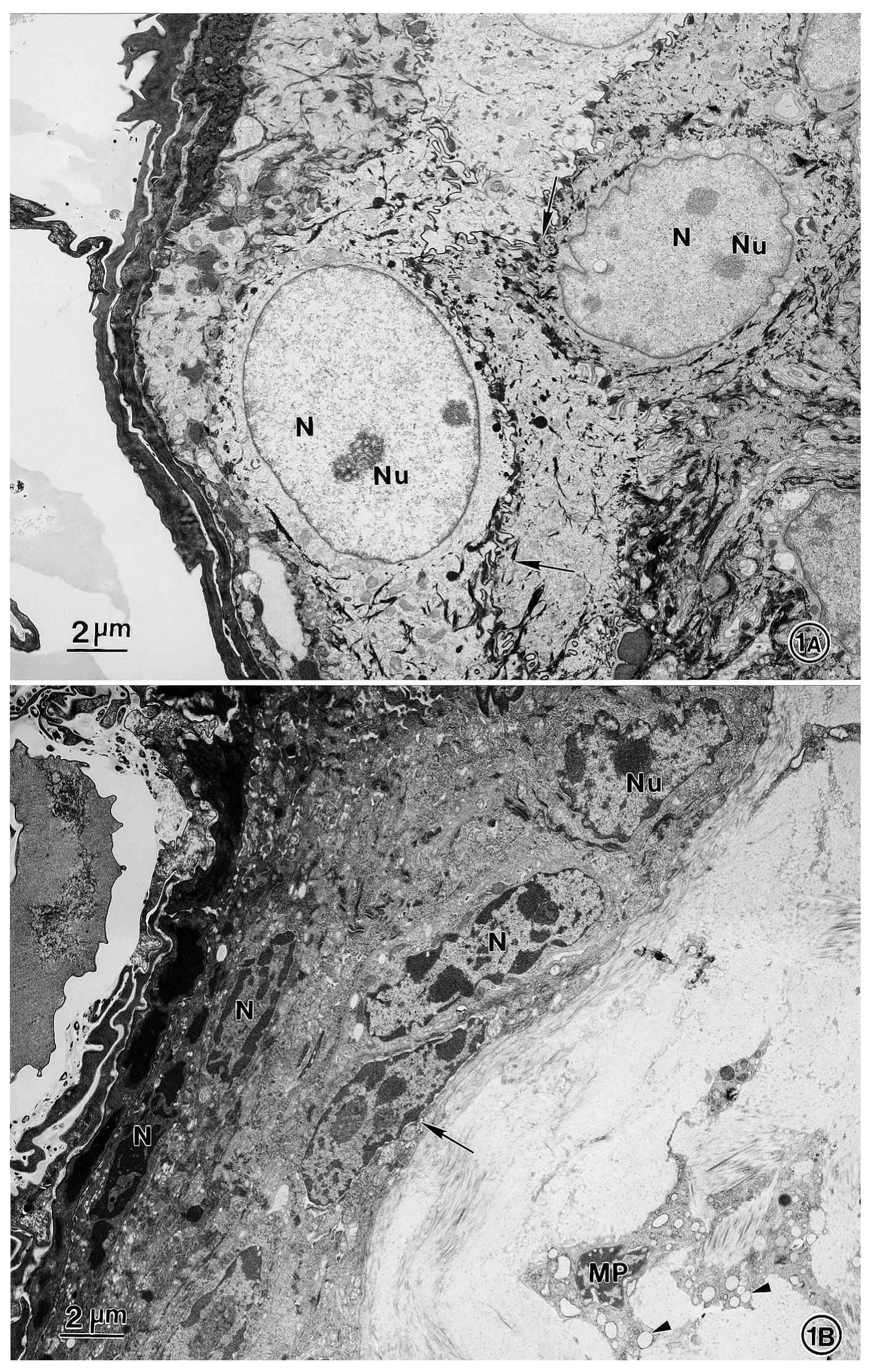 J. transmission electron micrographs of mouse skin 5h after