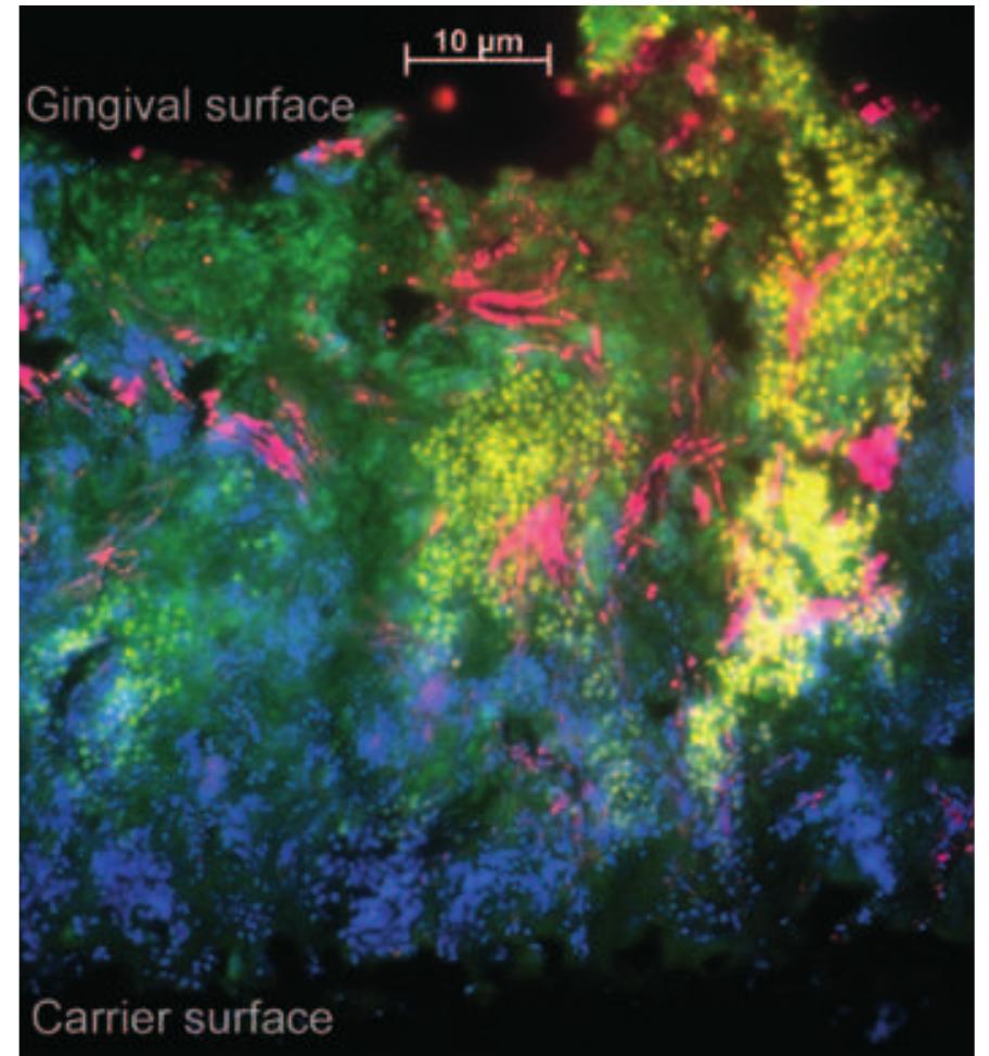 Fluorescence in situ hybridization of a subgingival biofilm