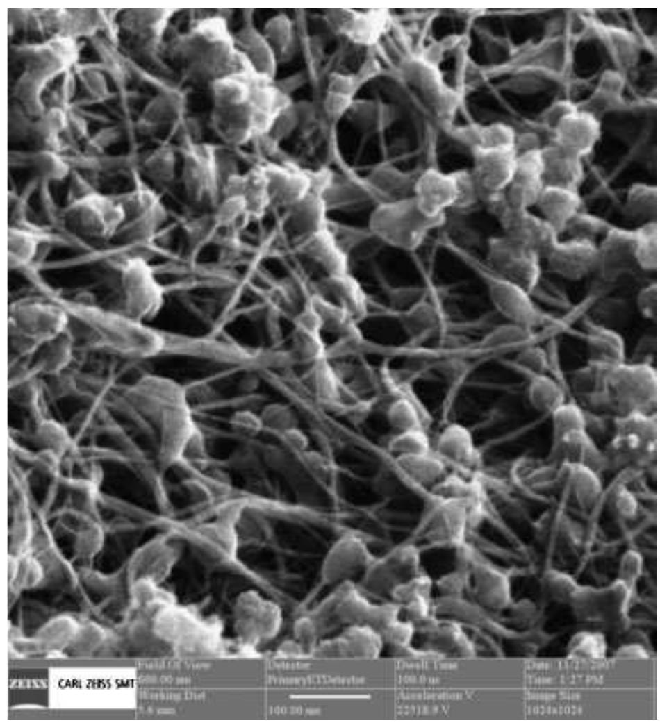 Helium ion microscope image of a single-walled carbon