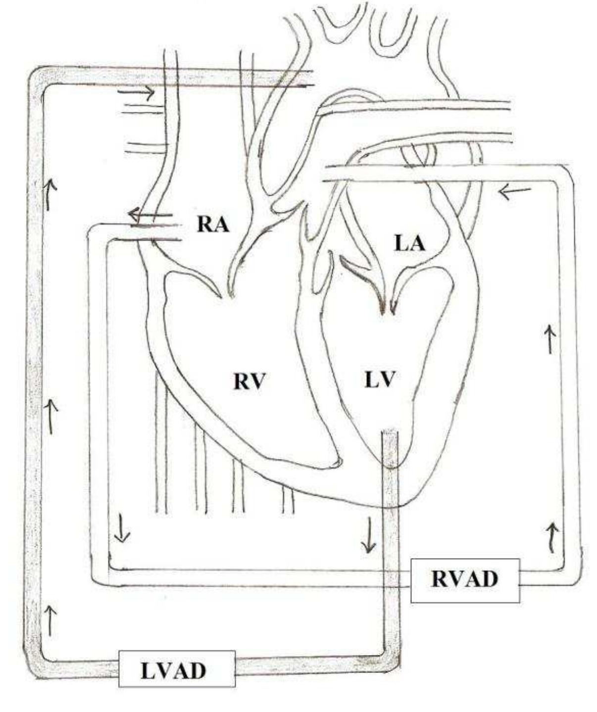 Be seen as a functional heart. figure 1-6 depicts the