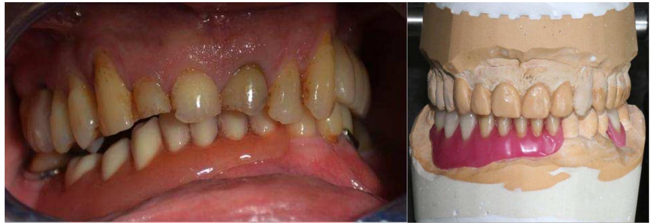 Initial occlusal situation the new validated vertical
