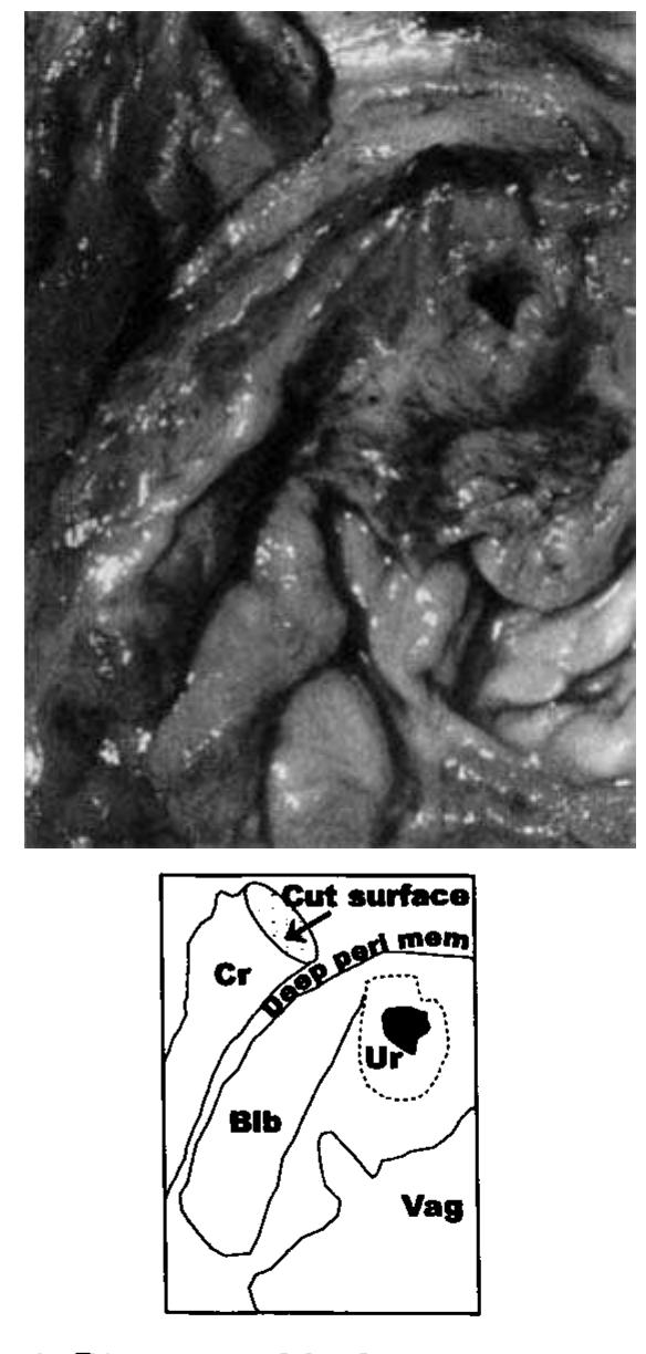 Figure 4 - from Anatomical Relationship Between Urethra and