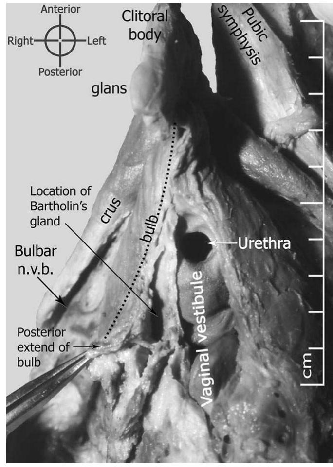(PDF) Anatomy of the Clitoris