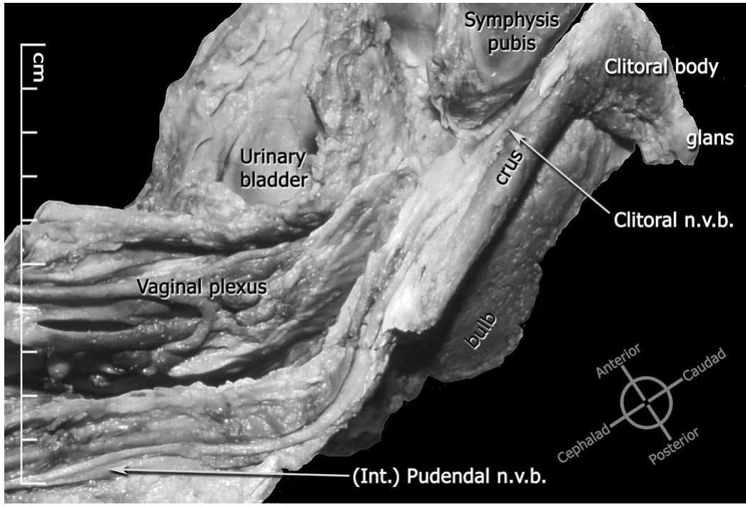 (PDF) Anatomy of the Clitoris