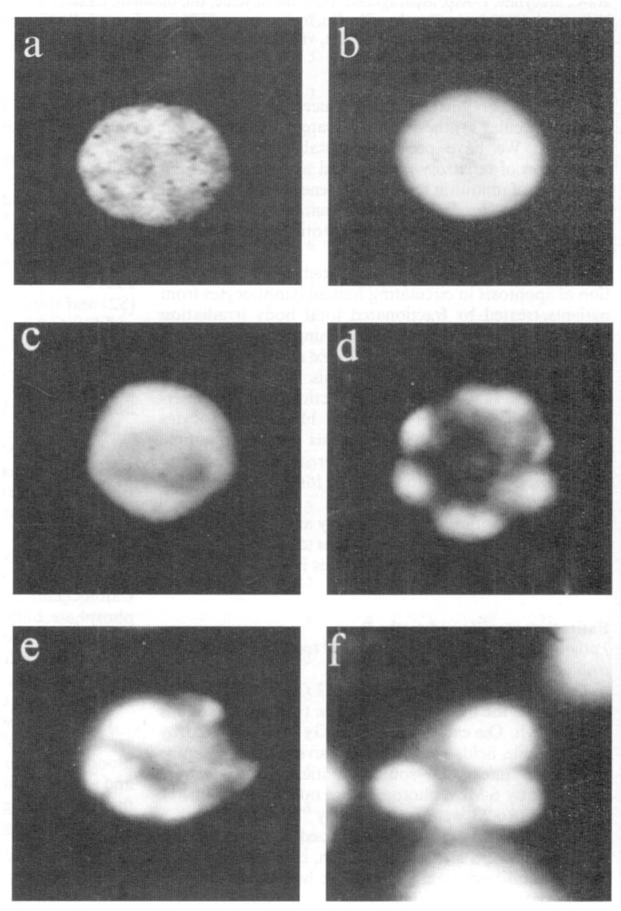 In lymphocytes committed to apoptosis, chromatin first