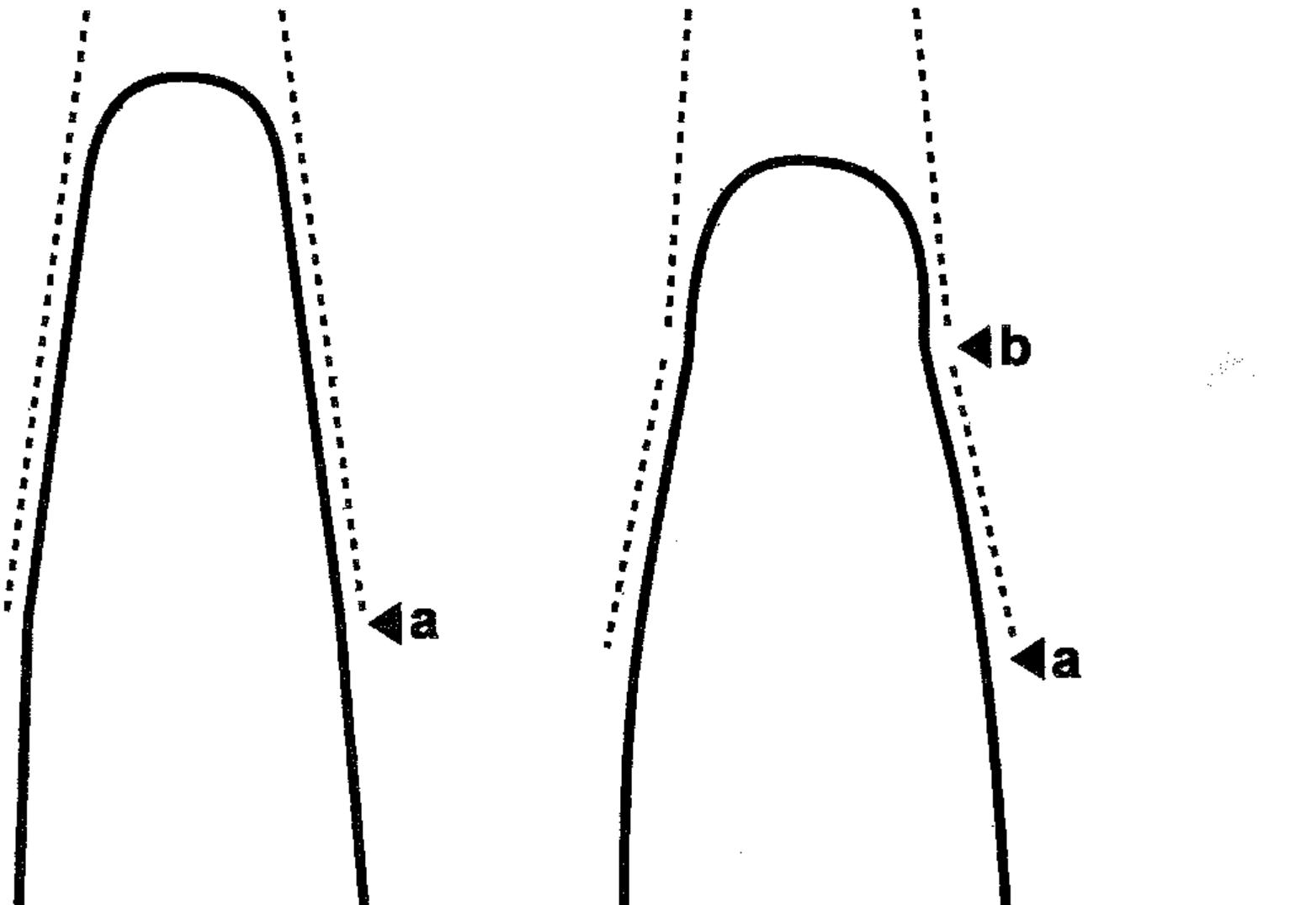 Differences between the cranial extremities (“heads”) of the