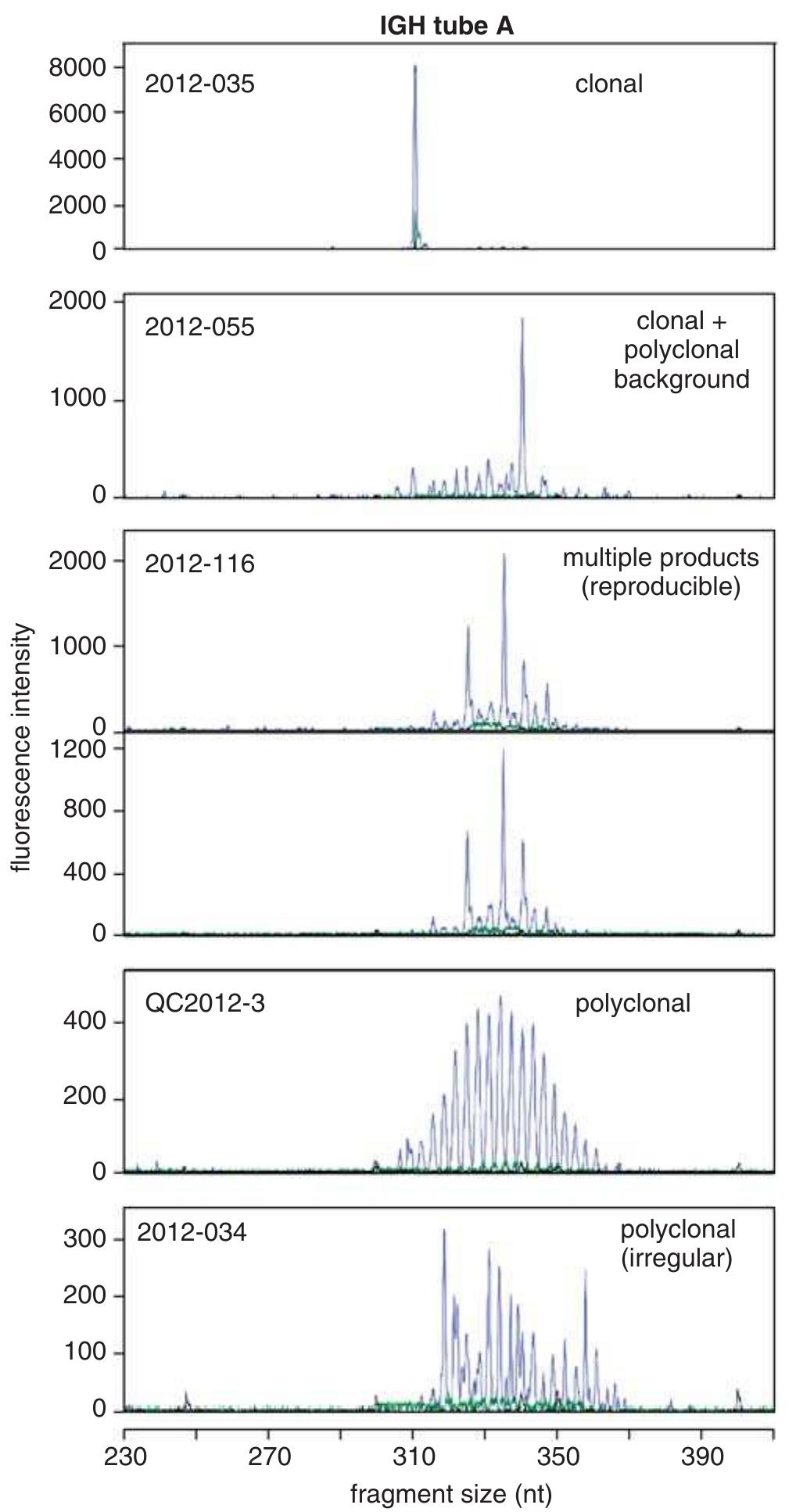 Examples of technical descriptions of different igh gs