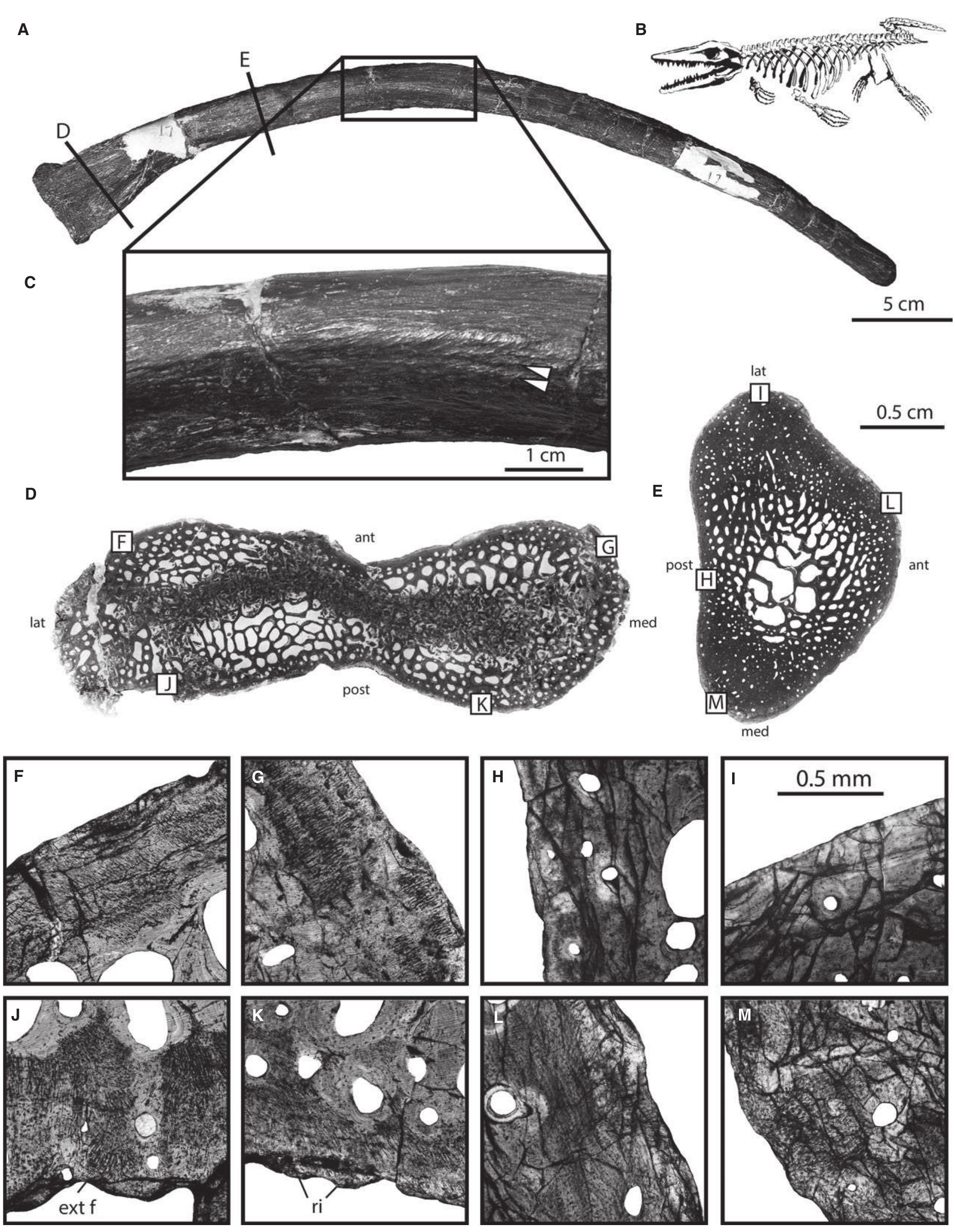 Surface morphology and bone histology of the left first