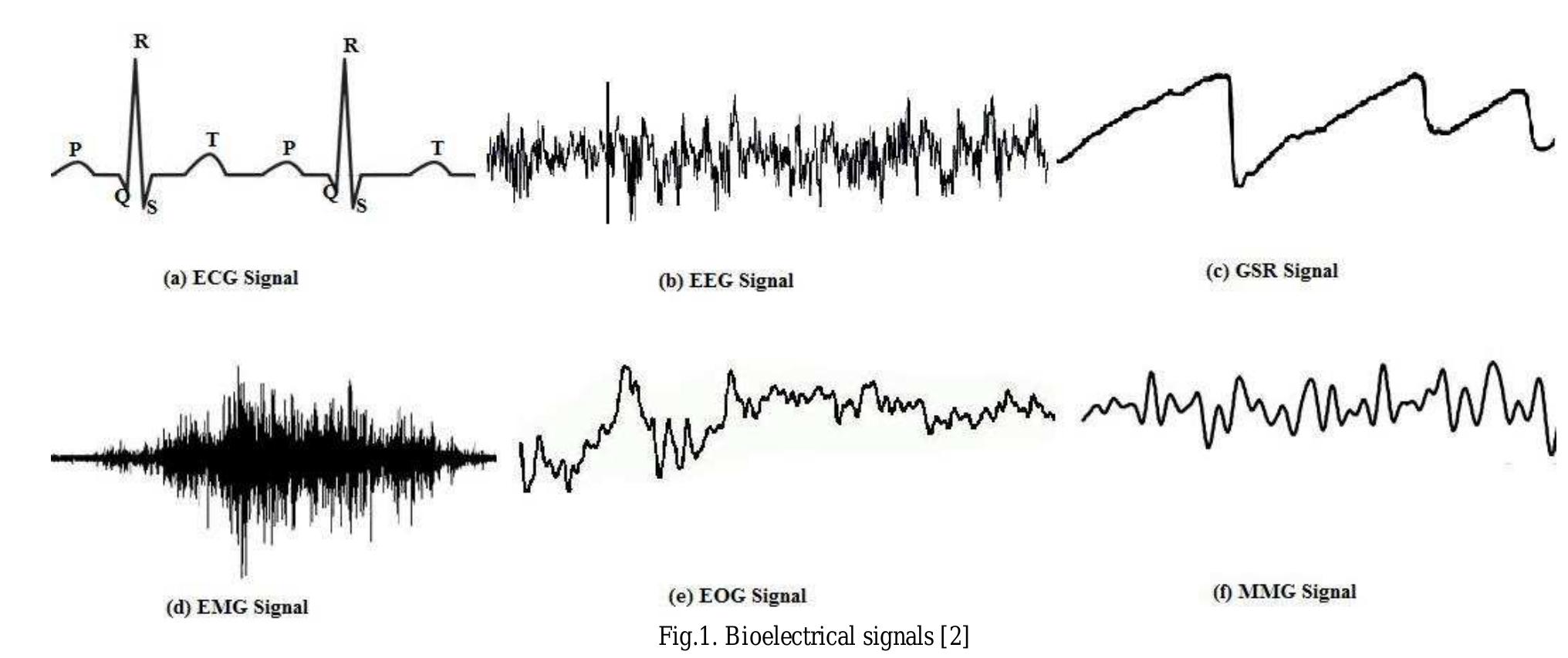 Extremely complex dynamical system [12]. the eeg can reflect