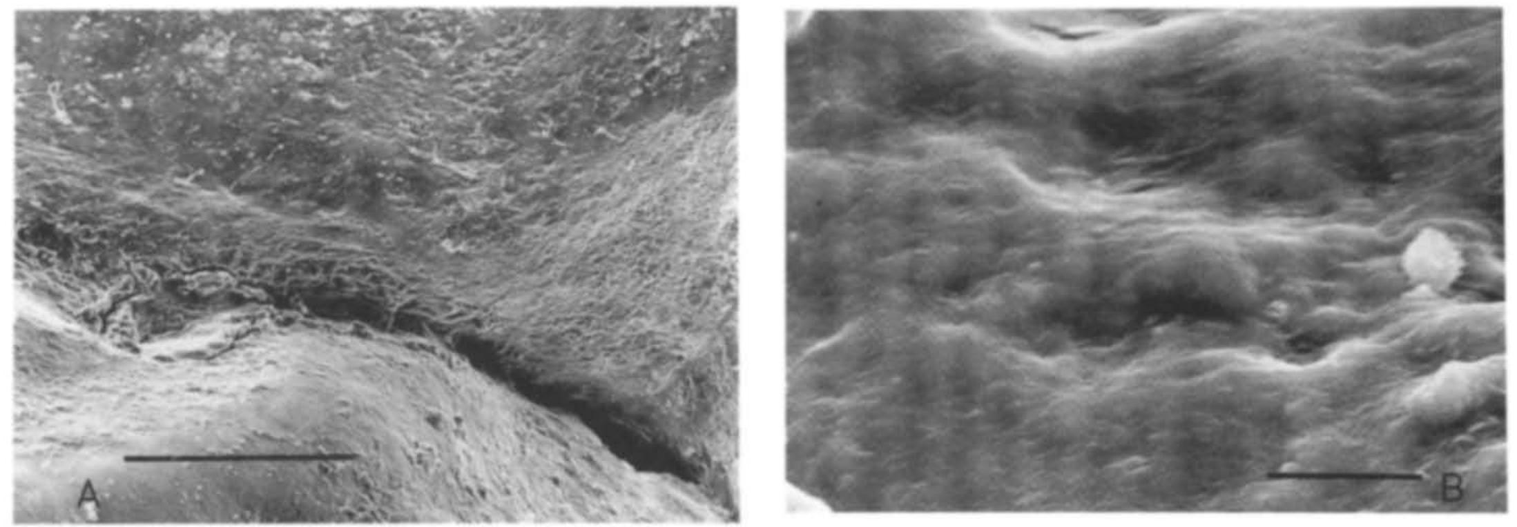 . 5. deeper parts of an unetched fissure specimen (control,