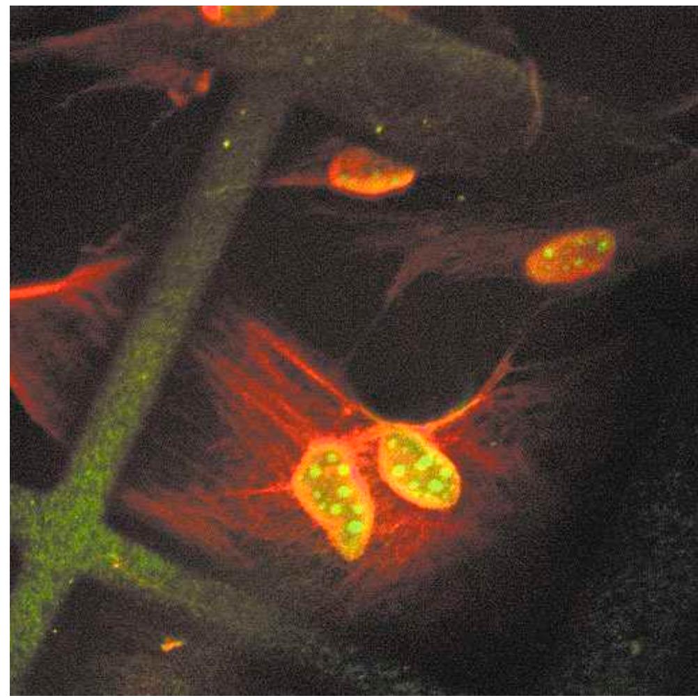 Specific actin labeling. dual-labeled sample examined with a