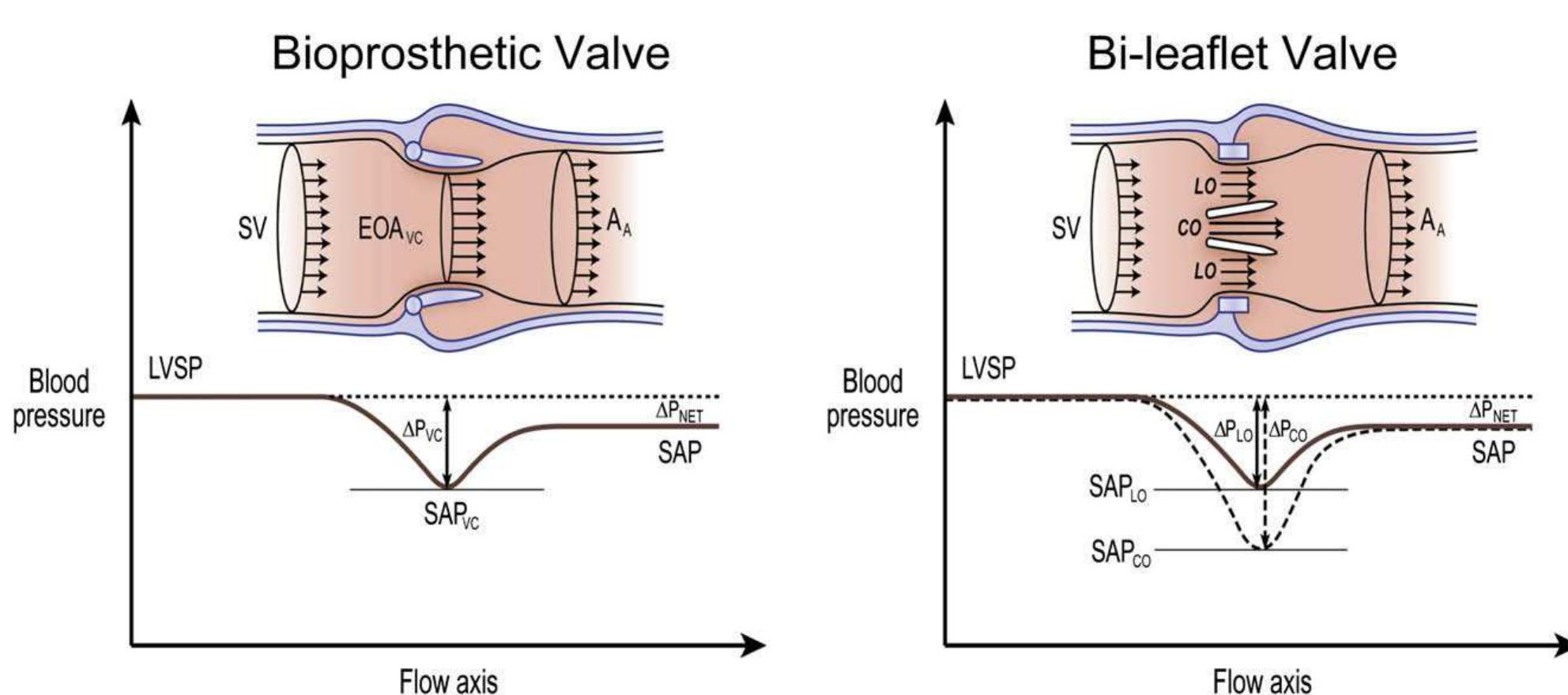 Schematic representation of velocity and pressure changes