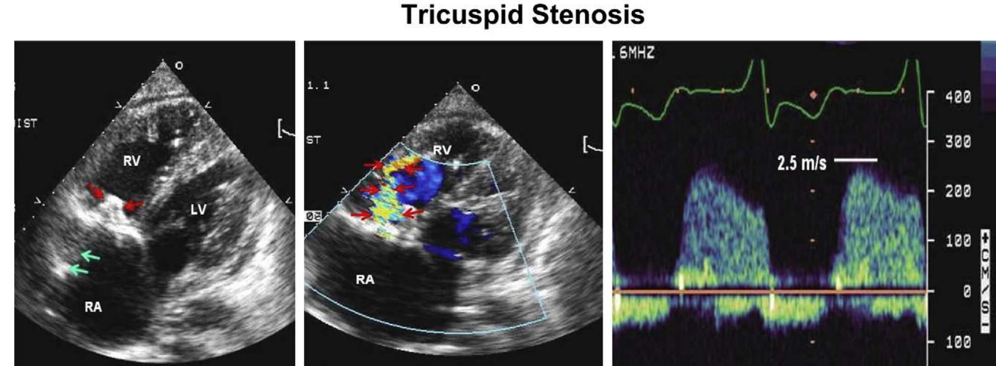 Transthoracic echocardiographic and doppler images in a