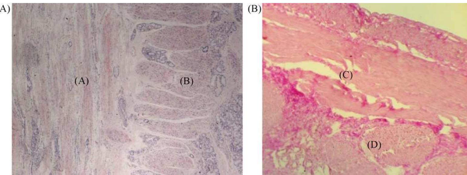 Histology of human tracheal smooth muscle. the two