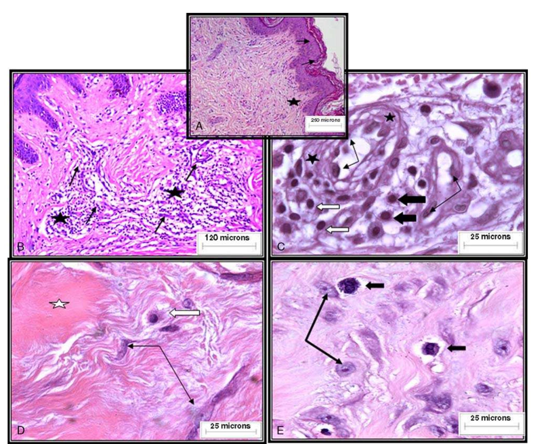 A, human foreskin showing the epidermal cell layers with