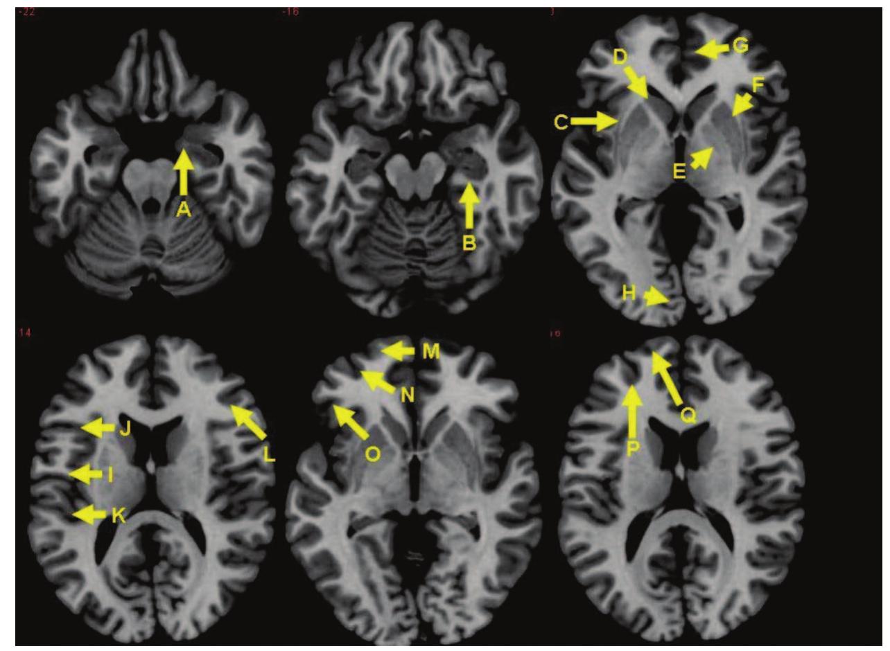 Anatomical areas. the anatomical areas found in the